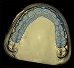 Surgical splint production file